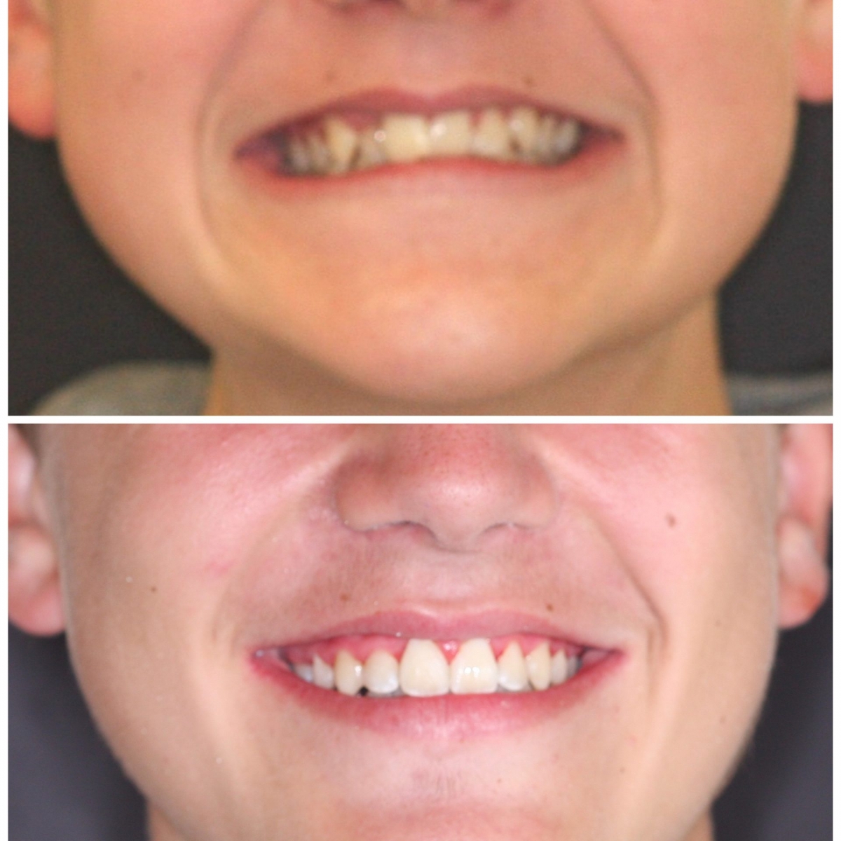 Fitzroy Dental